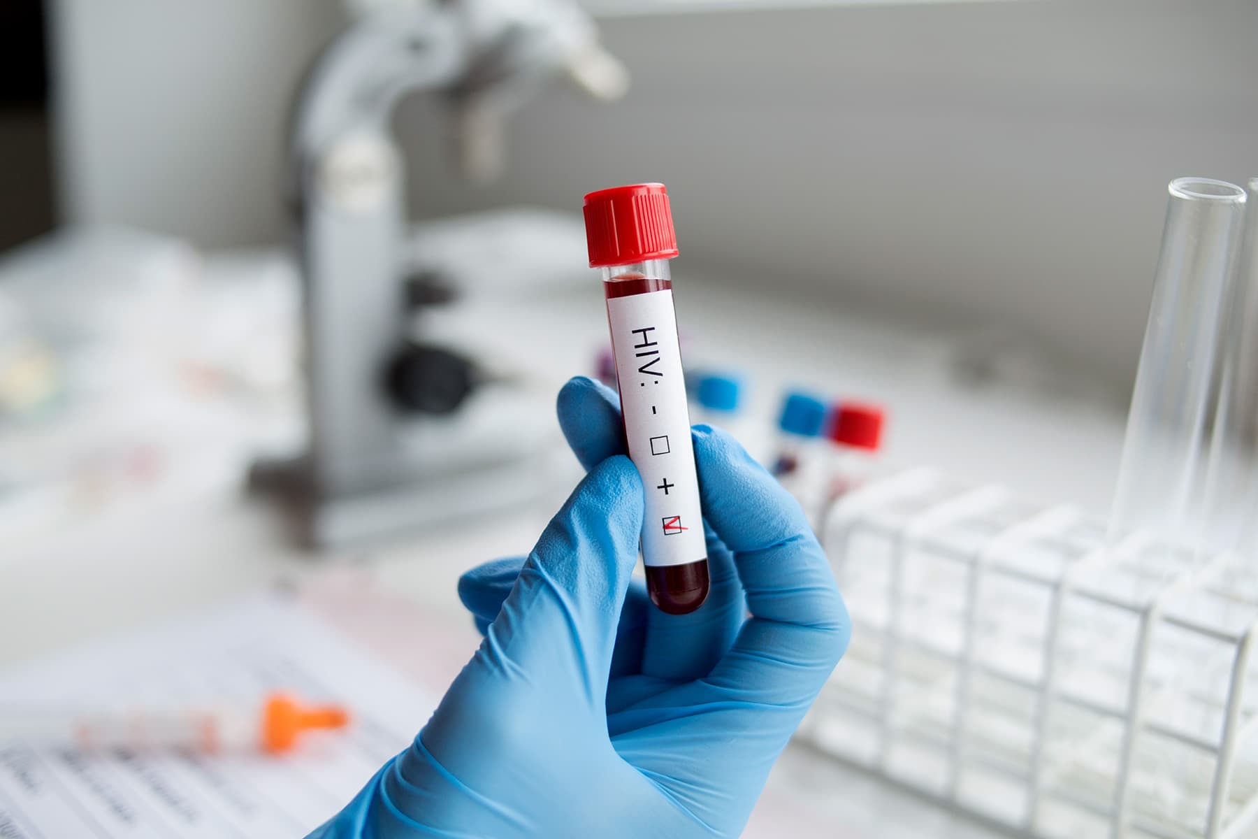 How Two People With HIV Suppressed Virus After Stopping Treatment ...